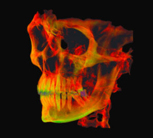 MeshLib - 3D Mesh Processing Library C++, Python, C#, C